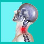 Herniated Disc in the Neck - Herniated Disc