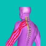 Pinched Nerve - Herniated Disc