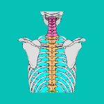 Thoracic Degenerative Disc Disease - Herniated Disc